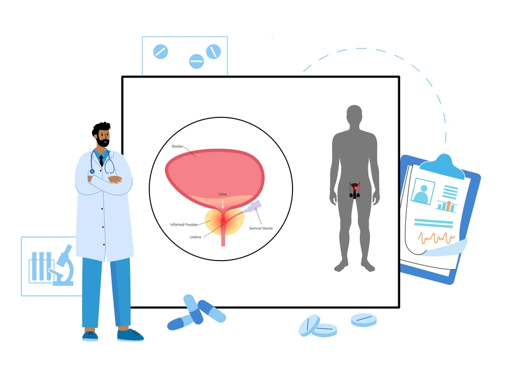 Est-ce qu'un adénome (HBP) est un cancer de la prostate